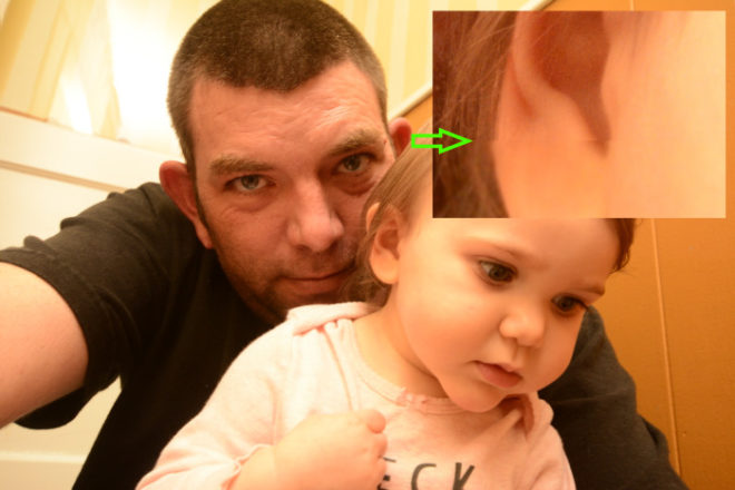 Alternative method for half grey or truncated JPEG photo repair ...